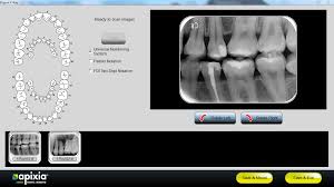 APIXIA EXM PSP 108M SCANNER - איזידנט